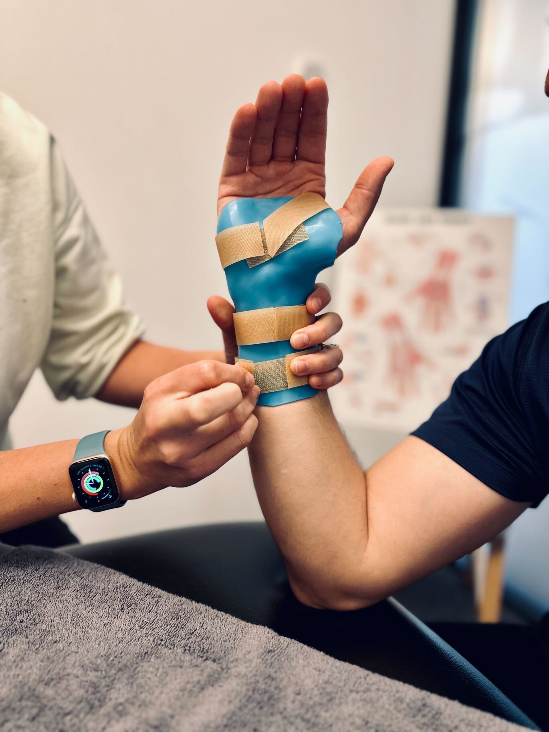 Casting - Barangaroo Physio | Upper Limb Casting Services